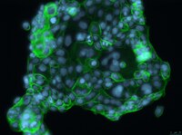 Calu-3 Human Lung Adenocarcinoma Cell Line | SCC438